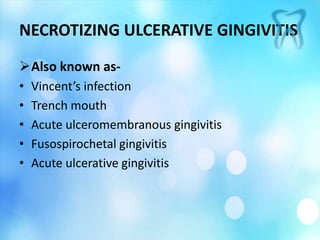Necrotizing ulcerative gingivitis | PPTX