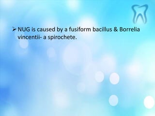 Necrotizing ulcerative gingivitis | PPTX