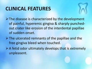 Necrotizing ulcerative gingivitis | PPTX