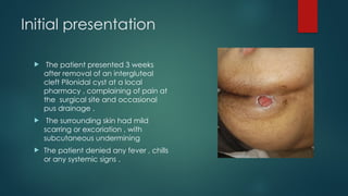 deep pelvic abscess in an immunocompromised.pptx