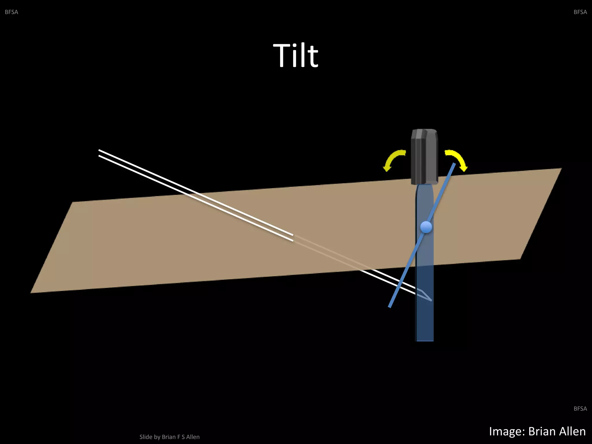 Needle probe movement for regional anesthesia | PPTX
