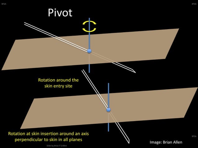 Needle probe movement for regional anesthesia | PPT