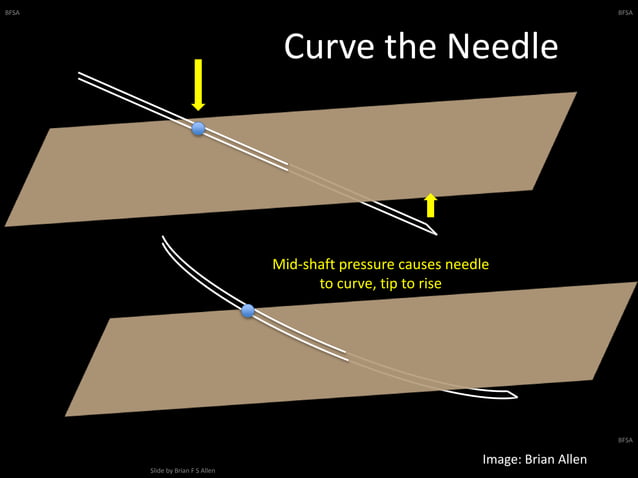 Needle probe movement for regional anesthesia | PPT
