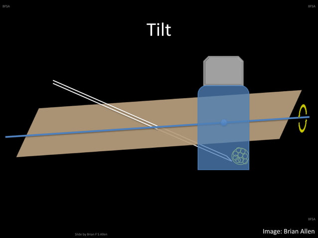 Needle probe movement for regional anesthesia | PPT