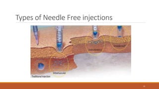 Needle free injections | PPTX