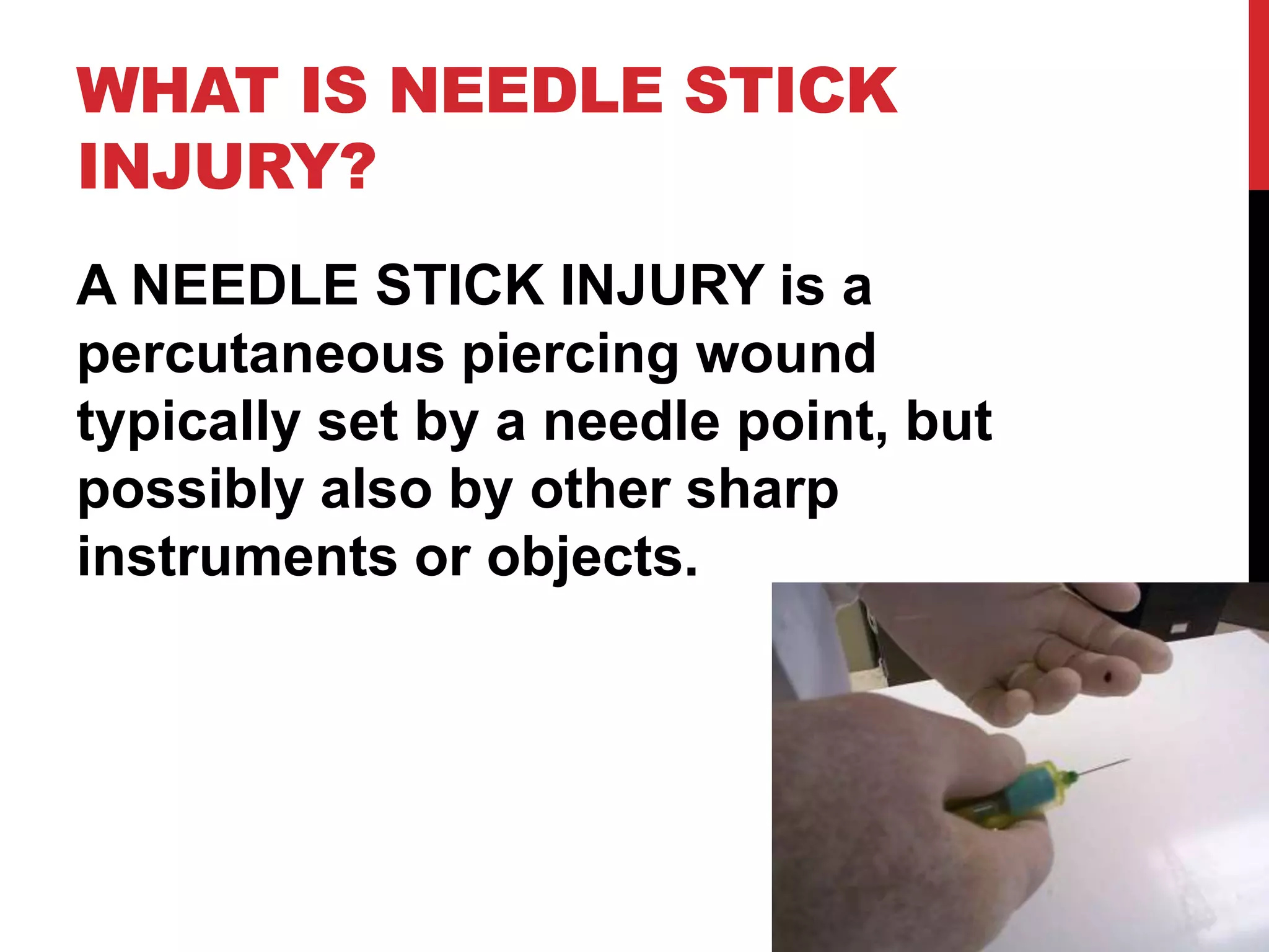 Needle stick injury | PPTX