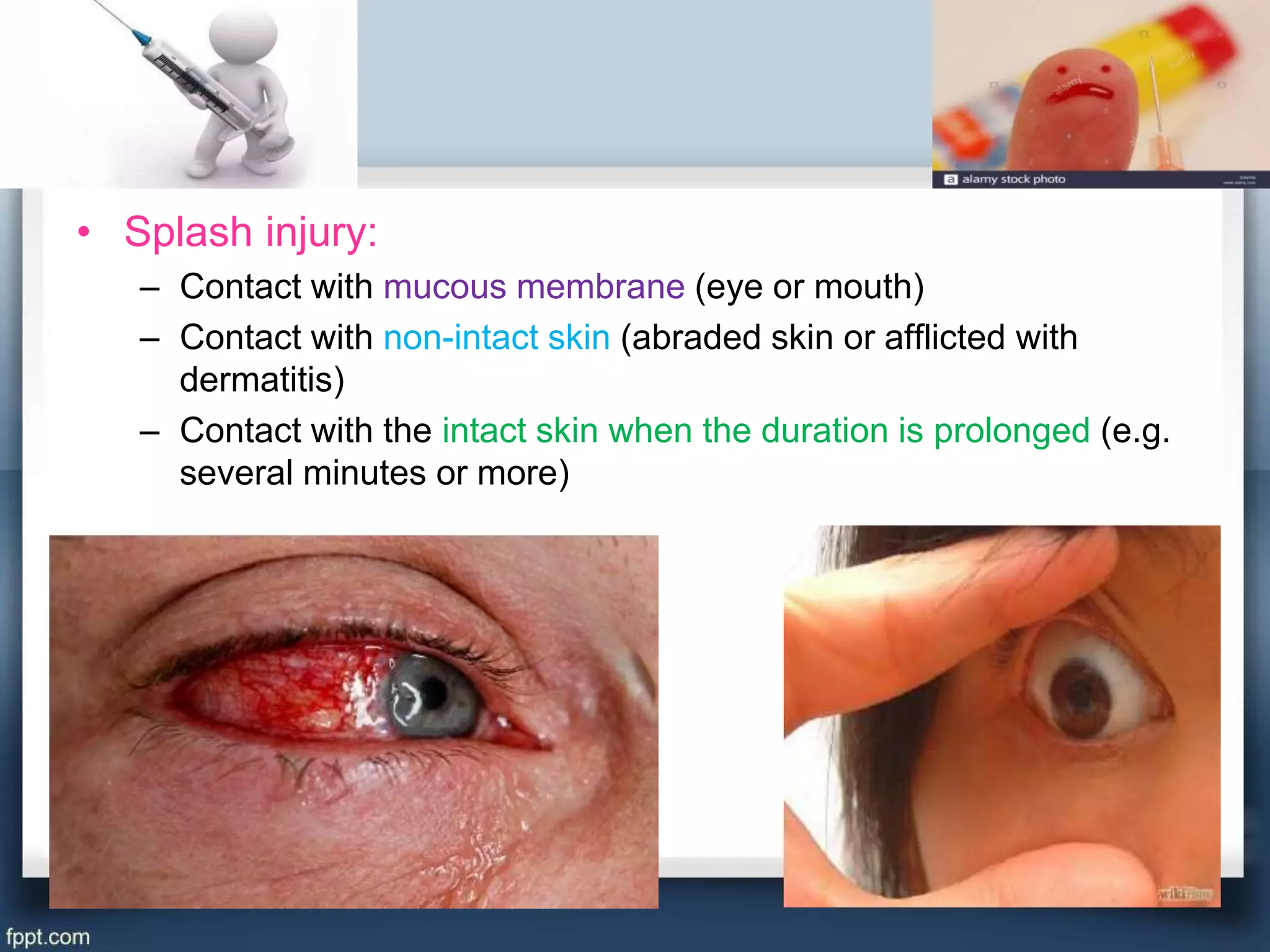 Needle stick injury Prevention and Management by Dr. Rakesh Prasad Sah ...