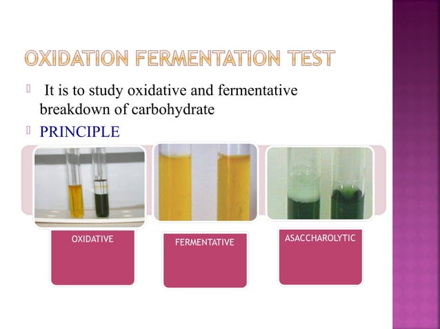 BIOCHEMICAL TESTS | PPT