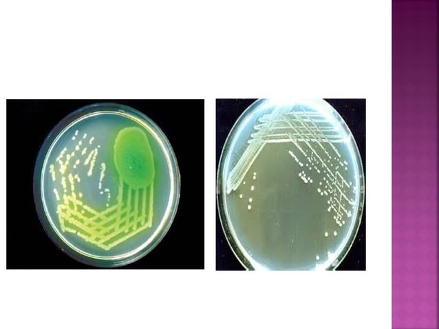 BIOCHEMICAL TESTS | PPT