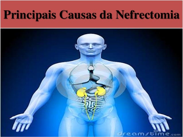 Nefrectomia repaginado