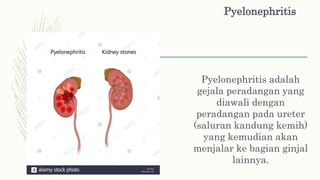 Gangguan Pada Sistem Eksresi Manusia | PPTX