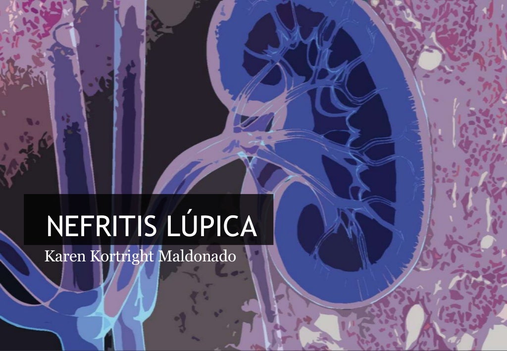 Nefritis Lpica