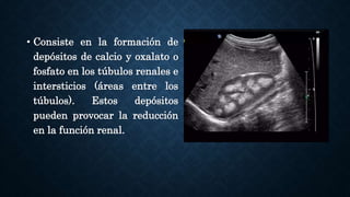 NEFROCALCINOSIS DATOS OBSERVADOS EN ULTRASONIDO.pptx