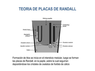 Fisiopatologia de la Nefrolitiasis | PPT