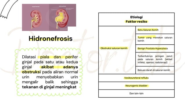Nefrologi Hipertensi_FreeClass Doctor.tobe.pdf