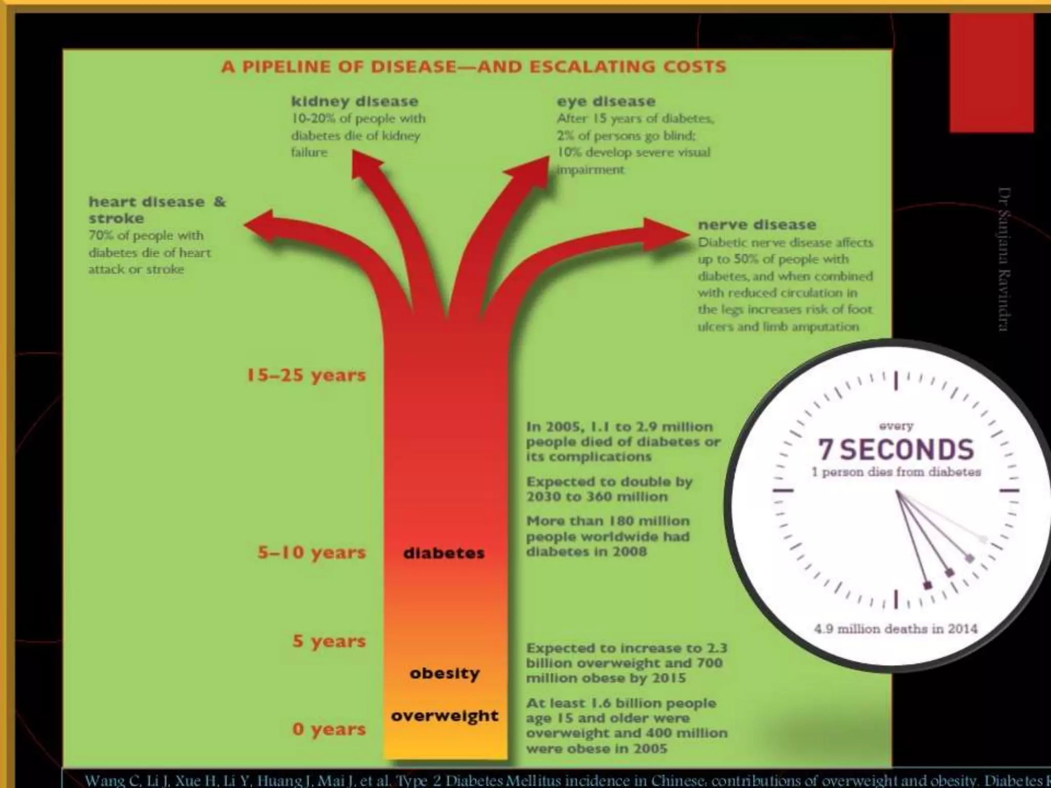 Nefropati diabetik -sony | PPTX