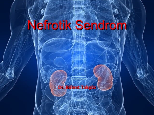 Nefrotik sendrom (fazlası için www.tipfakultesi.org ) | PPT