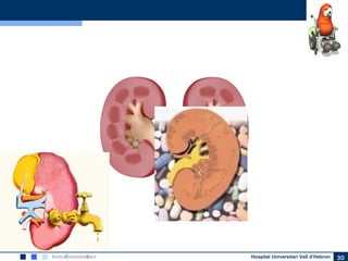Nefrotoxicidad inducida por medicamentos (1) | PPT