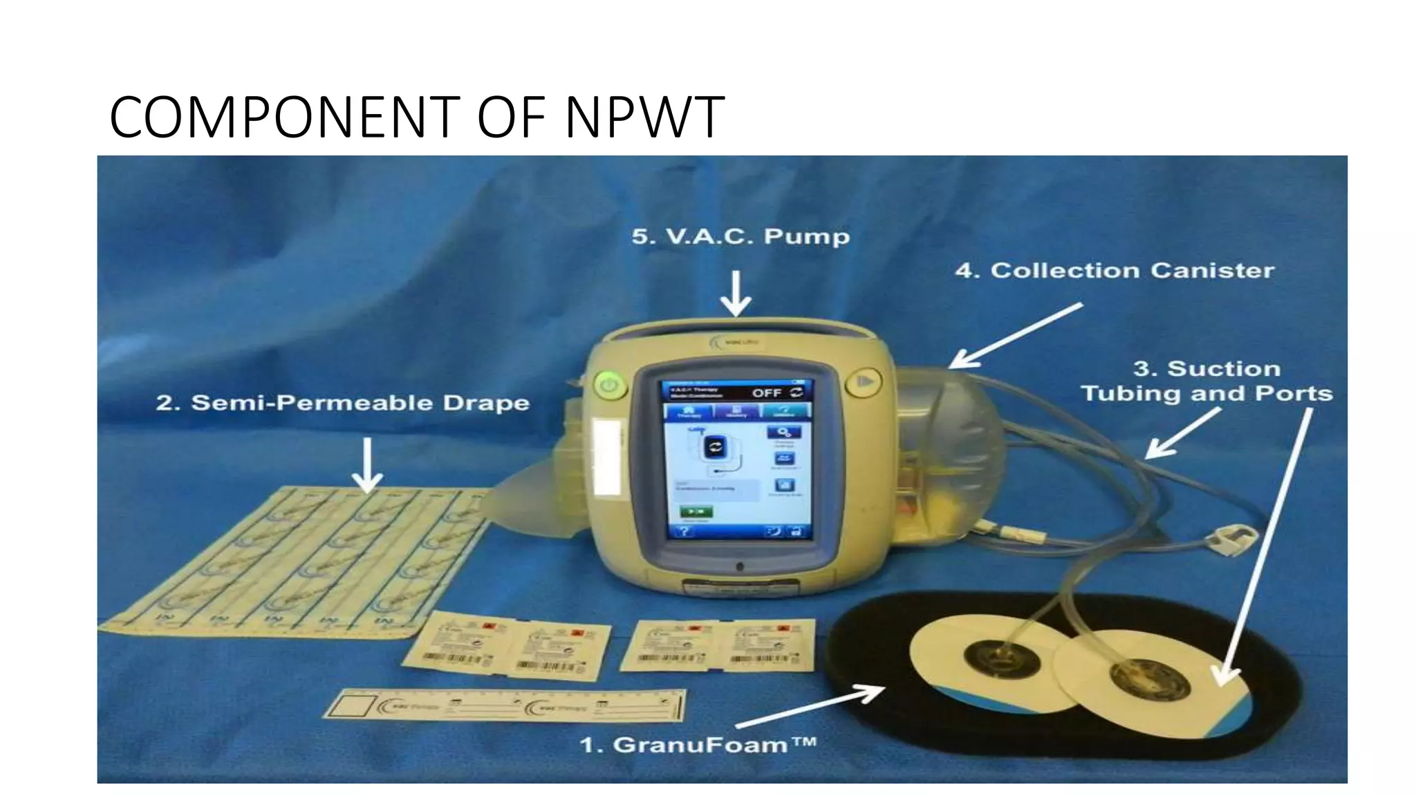 Negative pressure wound therapy | PPTX