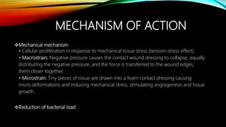 Negative pressure wound therapy | PPTX