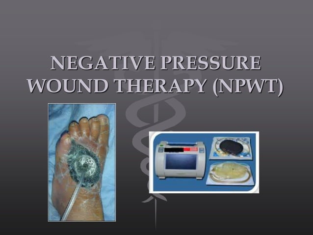 Negative Pressure Wound Therapy (NPWT) | PPTX | First Aid | Injuries