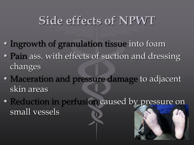 Negative Pressure Wound Therapy (NPWT) | PPTX | First Aid | Injuries