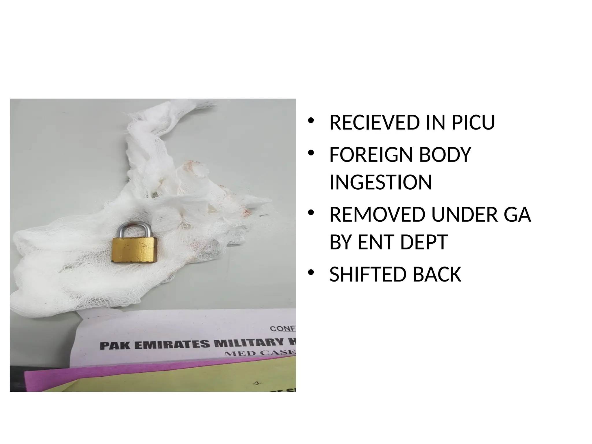 Negitive pressure pul edema.. case..pptx