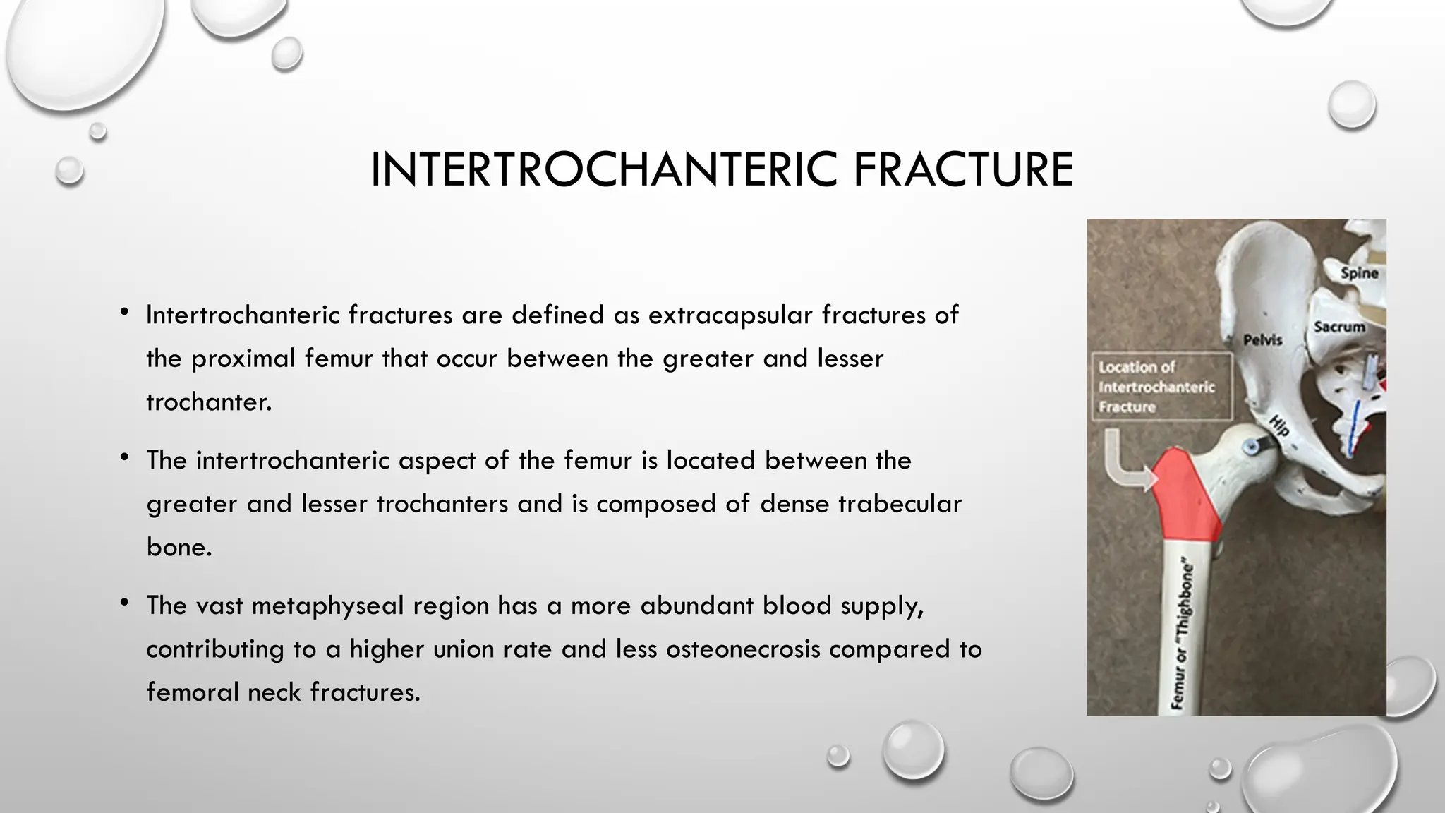 NEGLECTED INTERTROCHANTERIC fracture.pptx