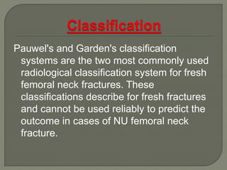 Neglected fracture neck of femur in young adults | PPTX
