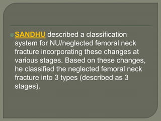 Neglected fracture neck of femur in young adults | PPTX