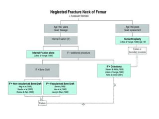 Neglected fracture neck of femur in young adults | PPTX