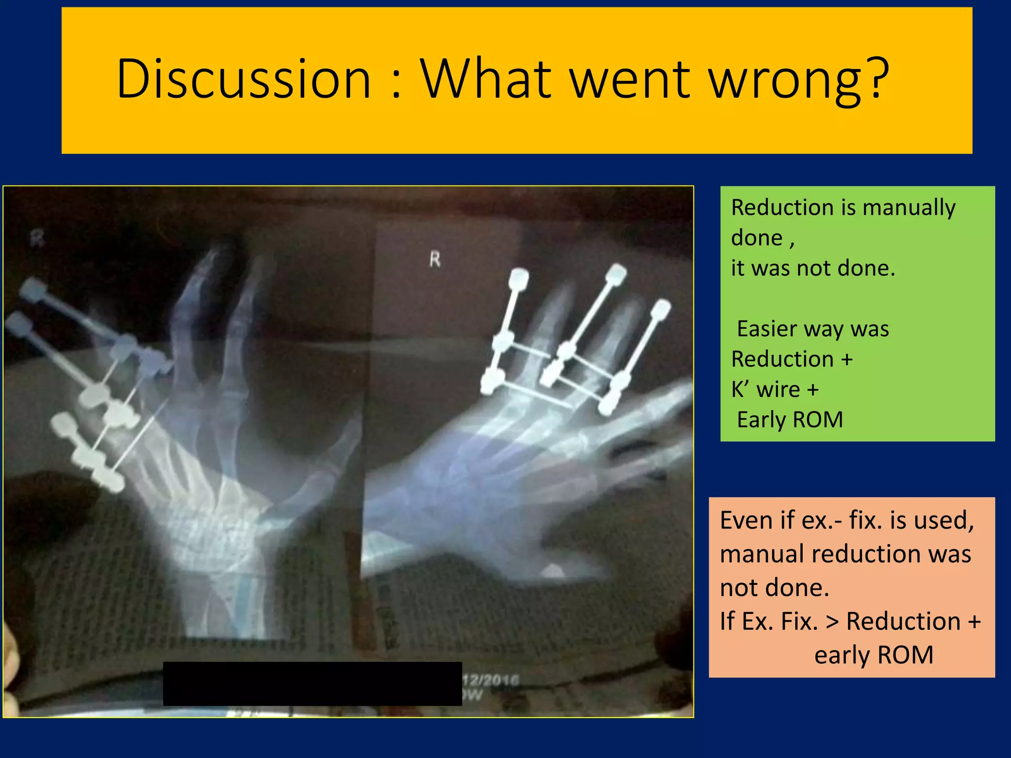 Neglected trauma hand | PPT