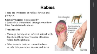 Neglected Tropical Disease epidemiology.pptx | Infectious Diseases ...