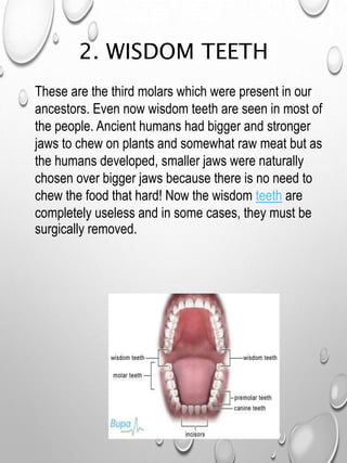 Vestigial Structures Wisdom Teeth