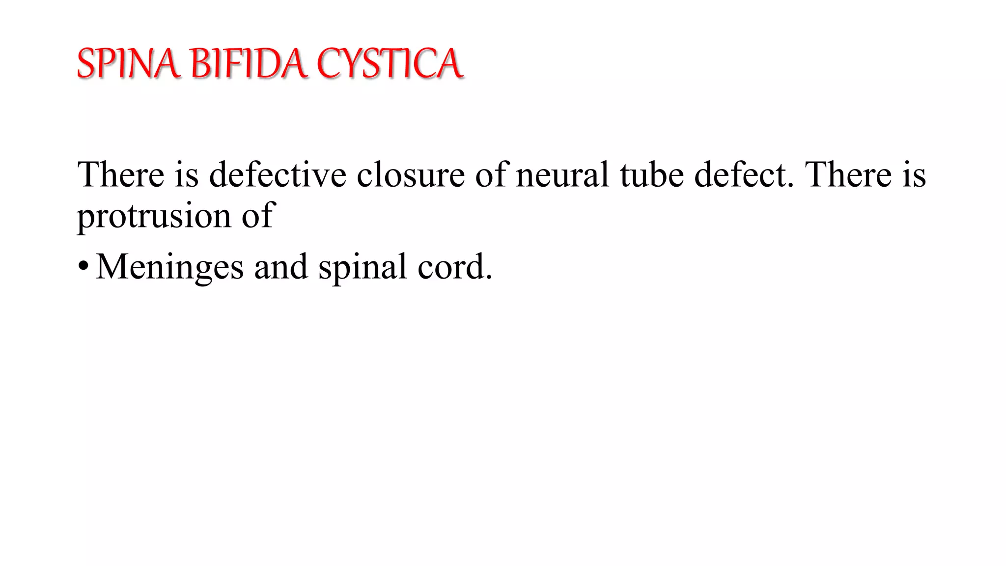neural tube defect.pptx