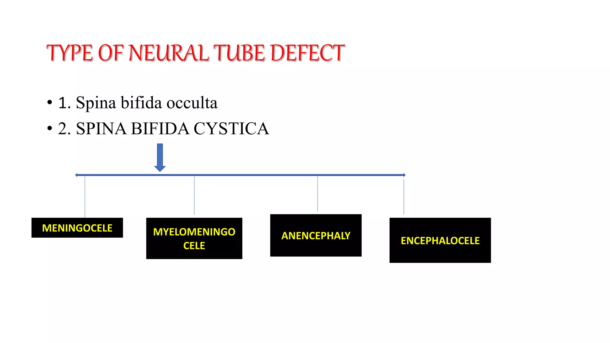 neural tube defect.pptx