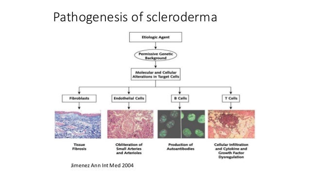 What is Raynaud's, what is scleroderma?
