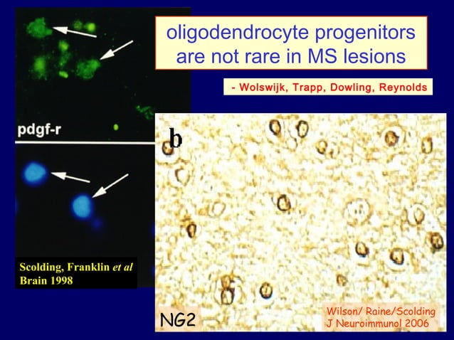 Advances in stem cell therapies in the treatment of MS | PPT | Free ...