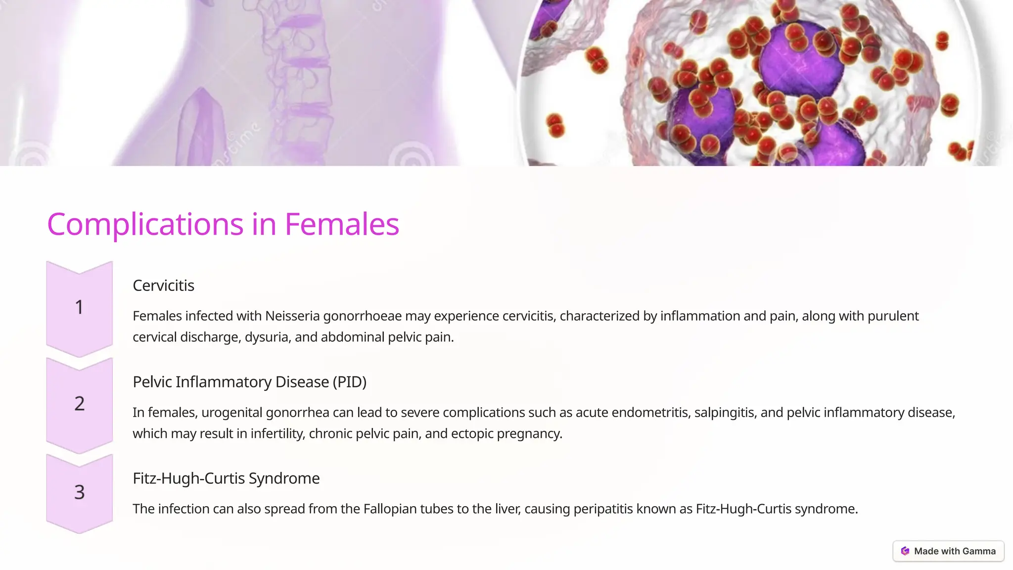 Neisseria-gonorrhea-A-Comprehensive-Overview.pptx