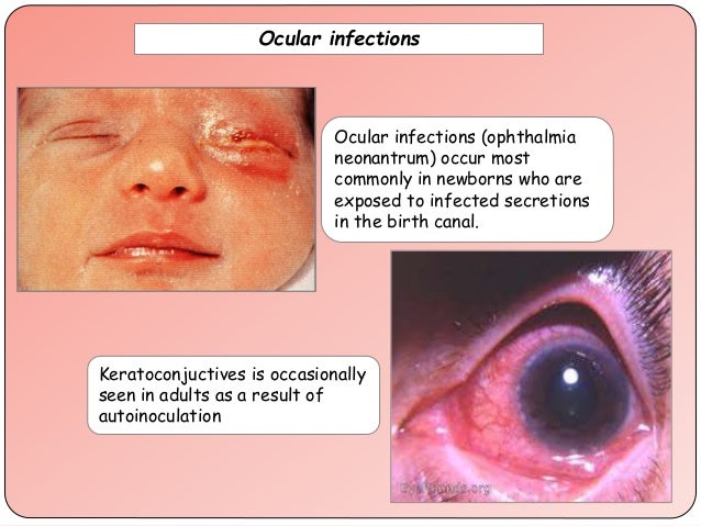 Neisseriacea and bacillus spp