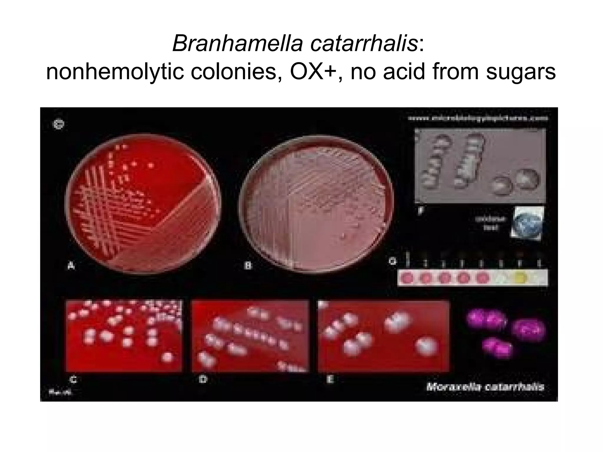 Neisseriaceae | PPT