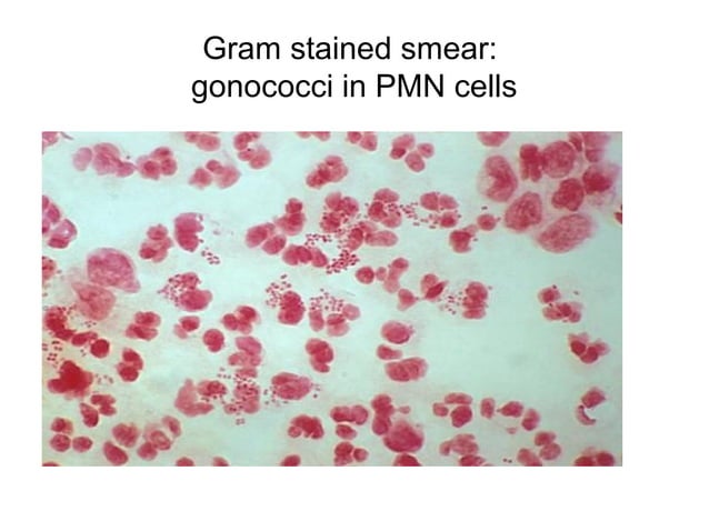 Neisseriaceae | PPT