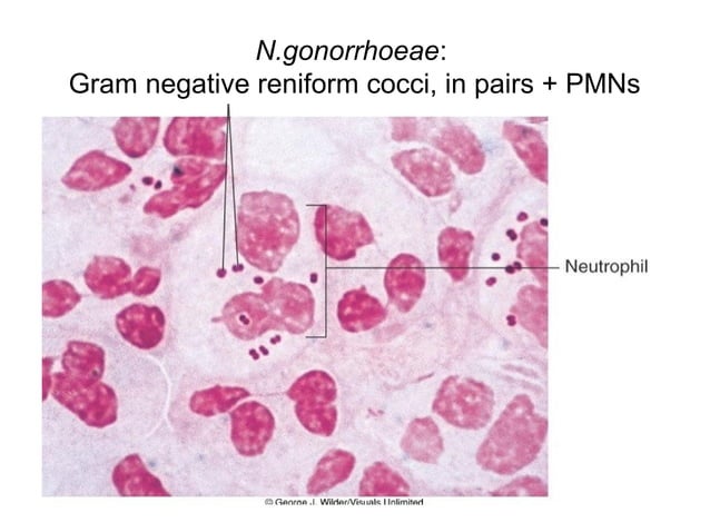 Neisseriaceae | PPT