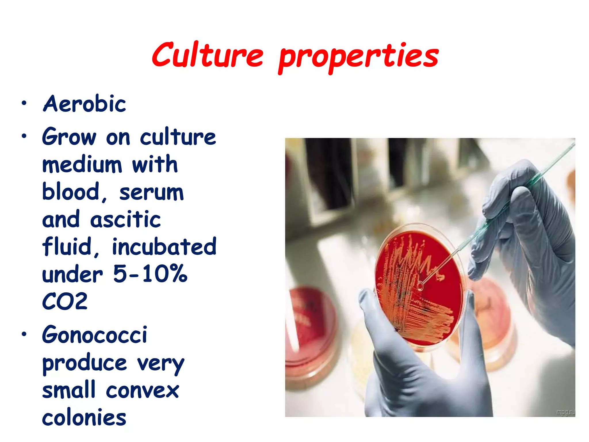 Neisseria gonorrhoeae (gonococcus).pdf