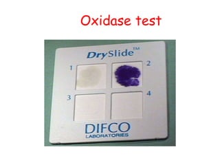 Neisseria gonorrhoeae (gonococcus).pdf