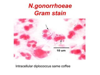 Neisseria gonorrhoeae (gonococcus).pdf