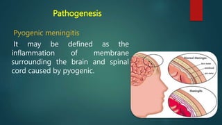 Neisseria Meningitidis Neisseria meningitidis Meningitidis Neisseria ...
