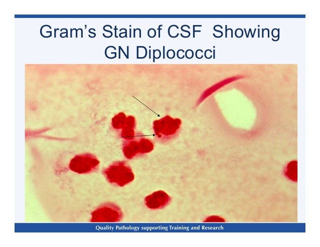 Neisseria meningitidis _clinical_laboratory_diagnosis_-plus (1)