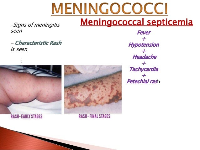 Neisseria by Dr. Rakesh Prasad Sah