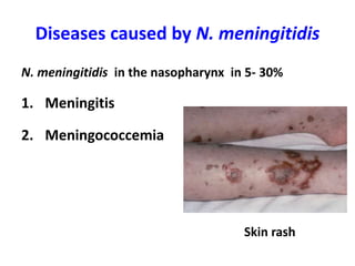 Neisseria - Prac. Microbiology | PPTX
